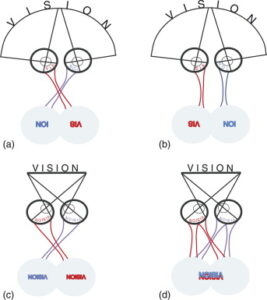 How Eye Dominance Influences Binocular Usage: Maximizing Visual ...